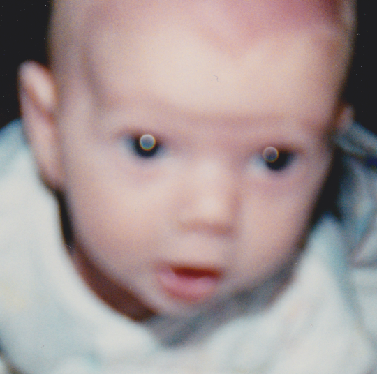 Joseph Shepard | American Sudden Infant Death Syndrome Institute